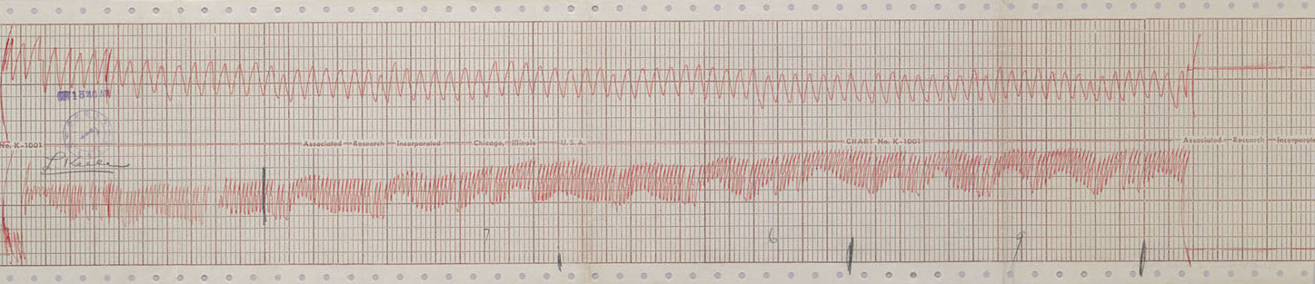 The Milkman – Captured and Exposed